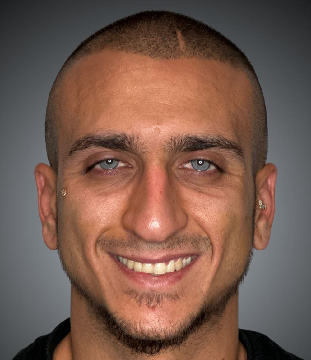 Sublimez Votre Regard avec Flaak – FLAAK New Color